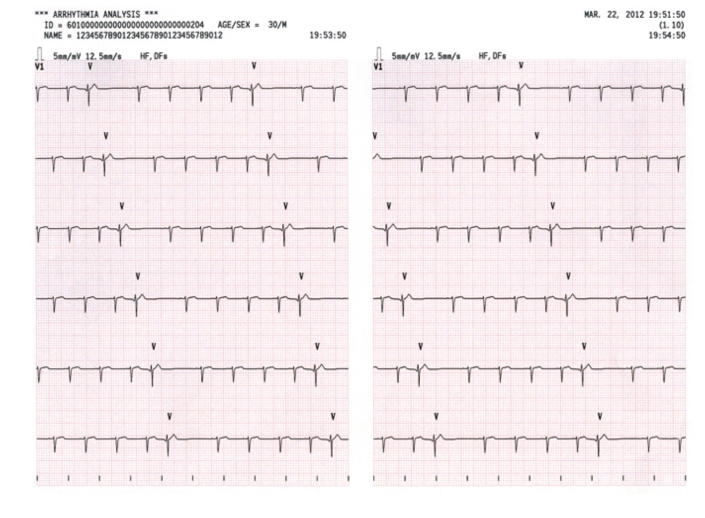 EKG Kenz Cardico 601 - PortalHealth