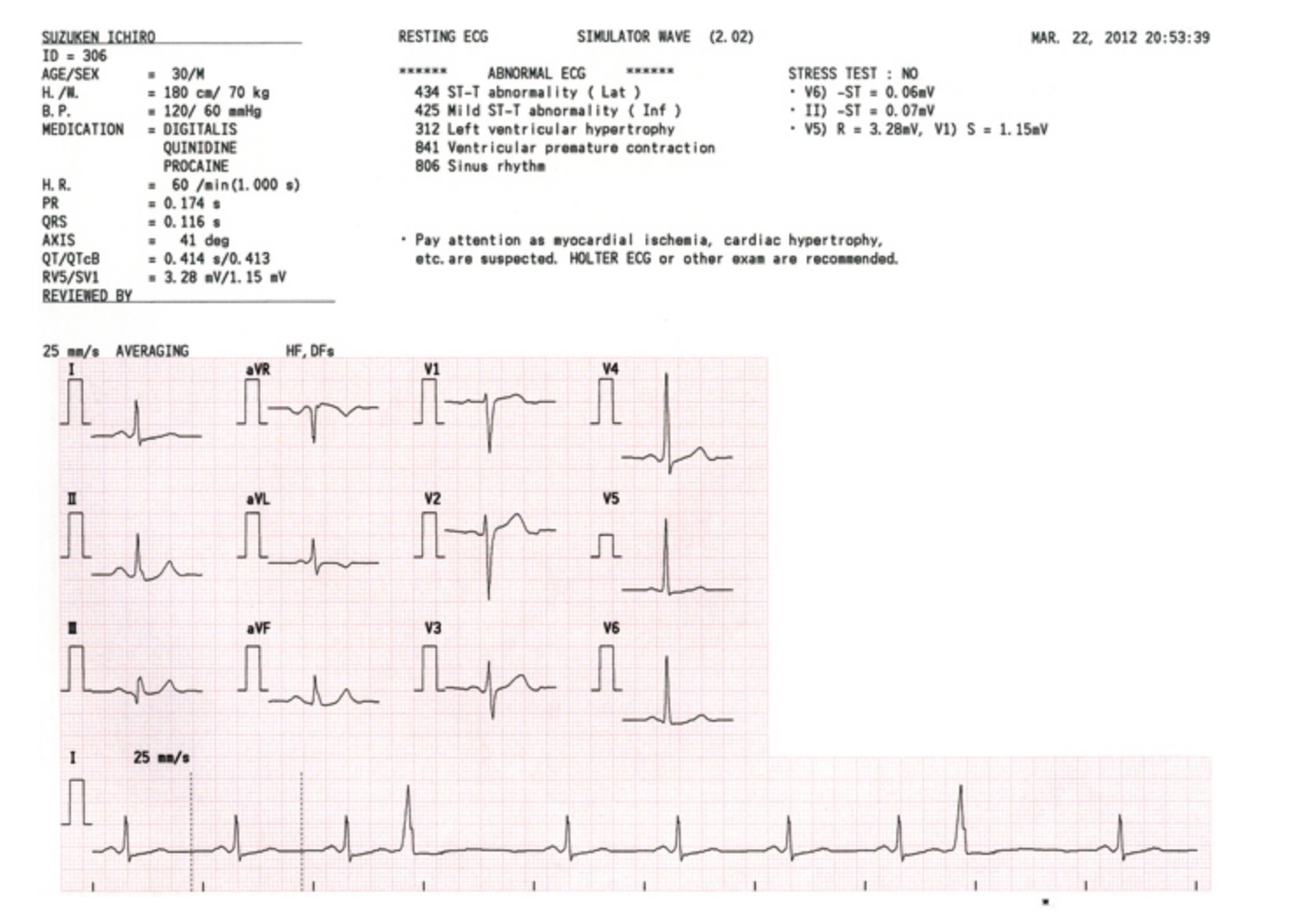 EKG Kenz Cardico 601 - PortalHealth