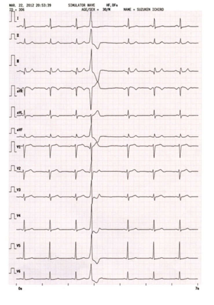 EKG Kenz Cardico 601 - PortalHealth